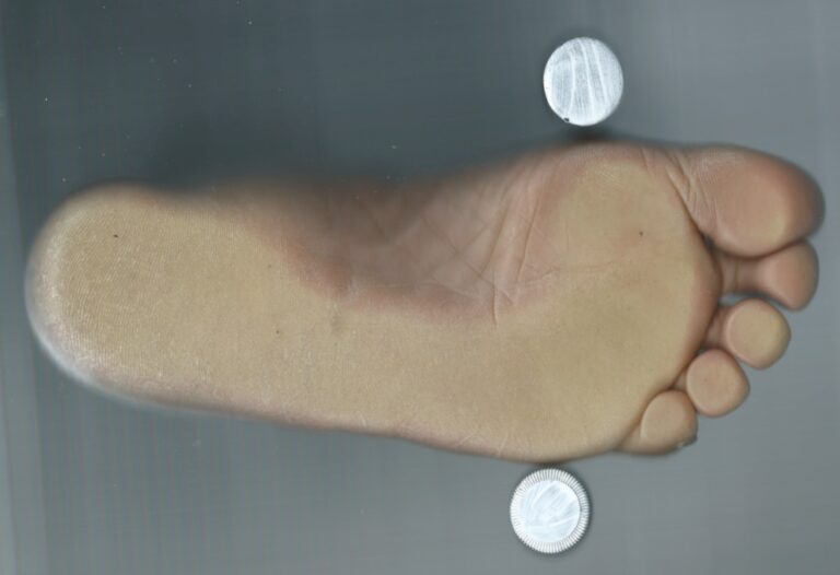 Importing 2D Foot Images for Designing Bespoke and Custom Shoe Lasts ...