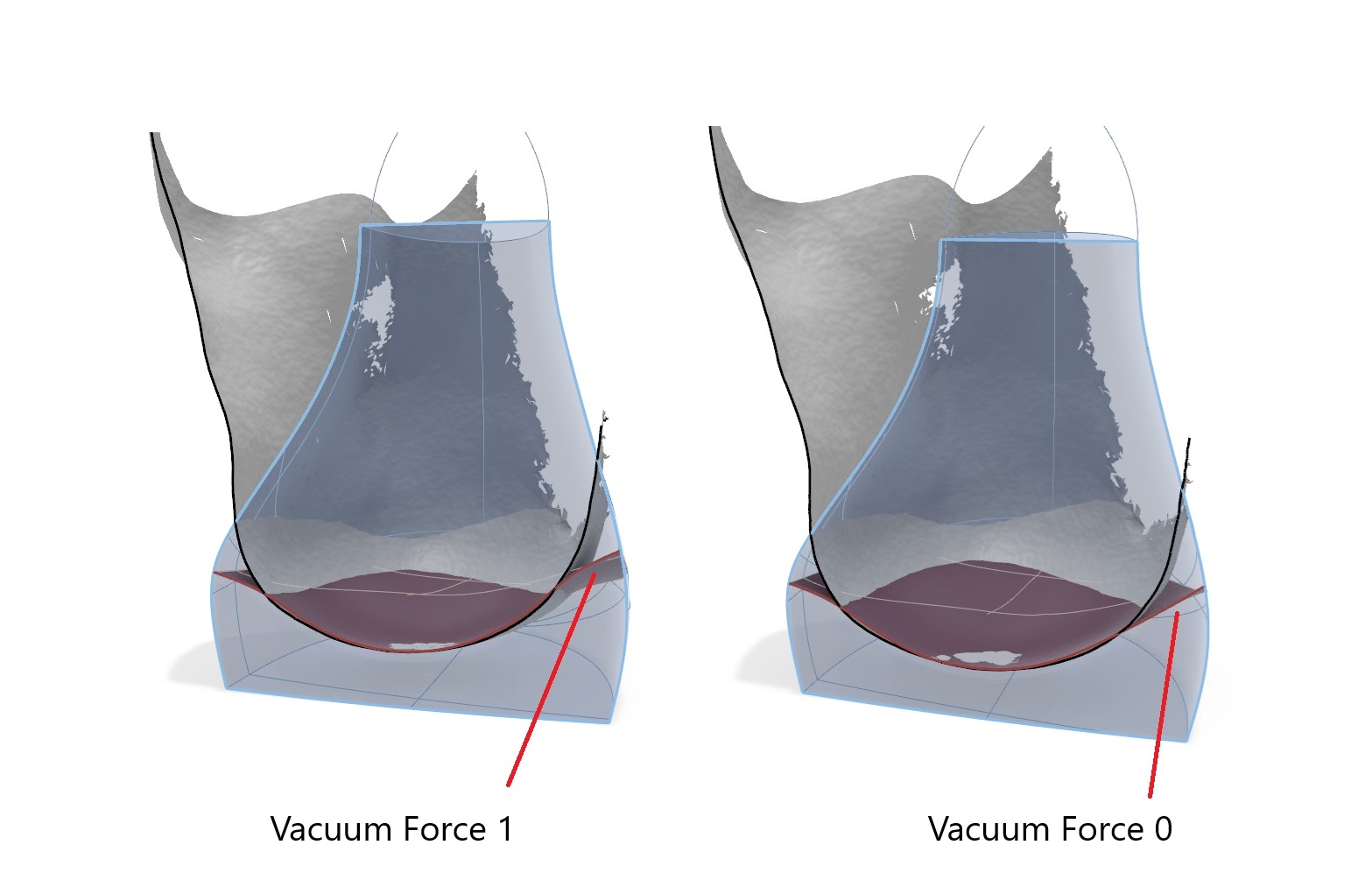 Digitally Vacuum Forming Orthotics to Plantar Foot Models - 3DShoemaker